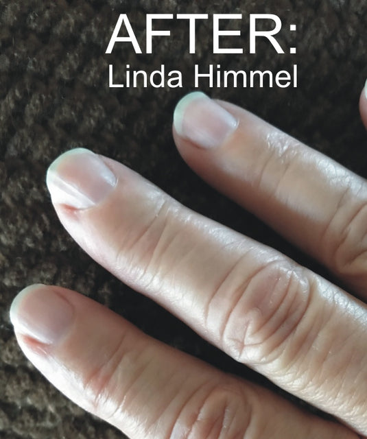 FlexiNail Fingernail Conditioner Treatment for Dry, Weak Brittle Nails