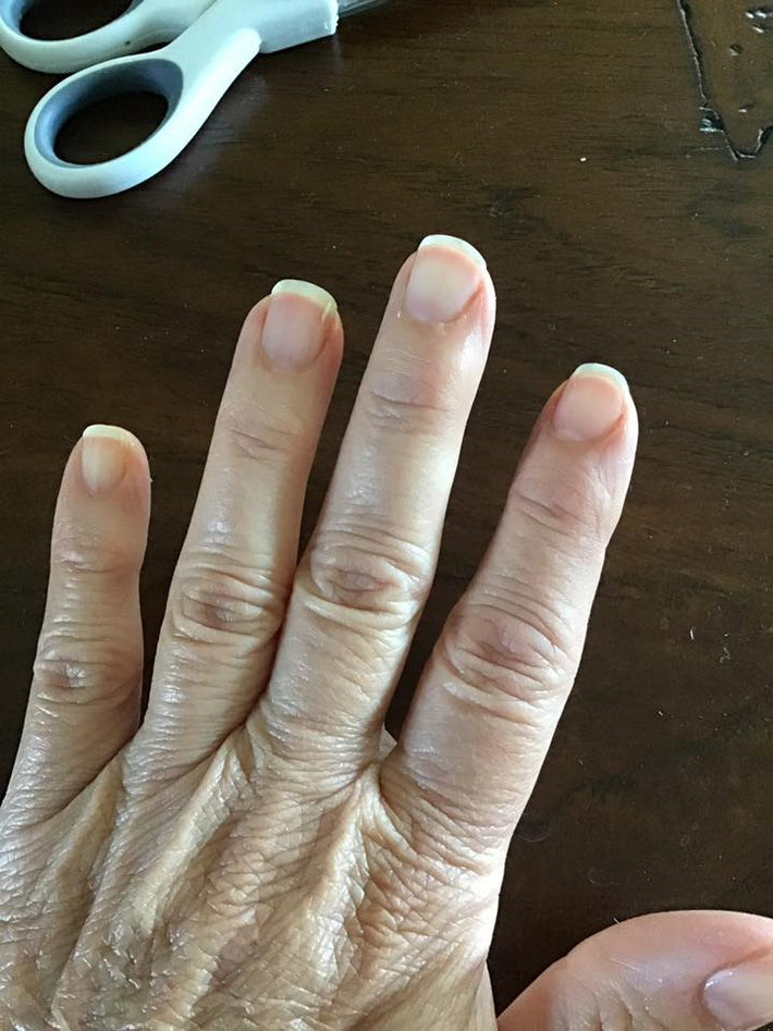 FlexiNail Fingernail Conditioner Treatment for Dry, Weak Brittle Nails